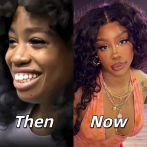 SZA Before Surgery: What Plastic Surgery Has She Had and Why Her Breast ...
